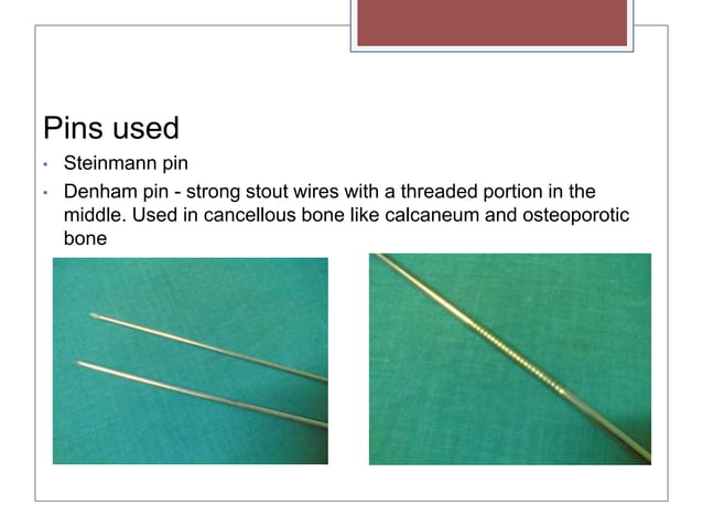 Ortho - Splinting, Traction, POP | PPT