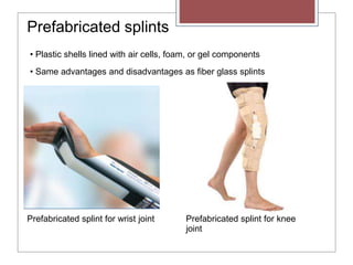 Ortho - Splinting, Traction, POP | PPT