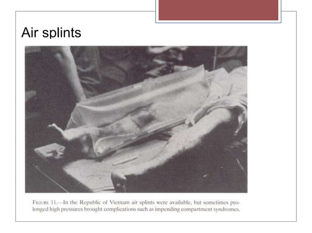 Ortho - Splinting, Traction, POP | PPT