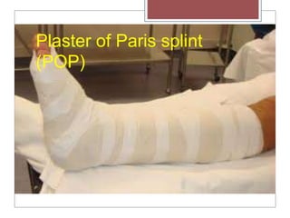 Ortho - Splinting, Traction, POP | PPT