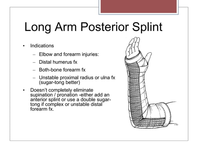 Ortho - Splinting, Traction, POP