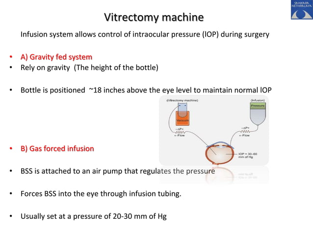 Vitrectomy: Development And Steps | PPTX | Eye and Vision Conditions ...