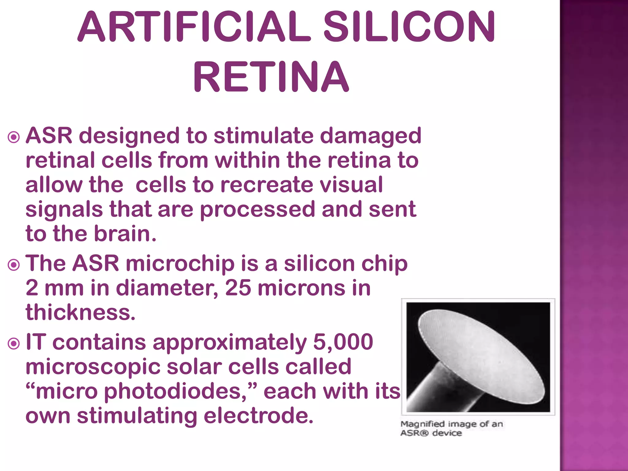 Silicon Retina | PPTX