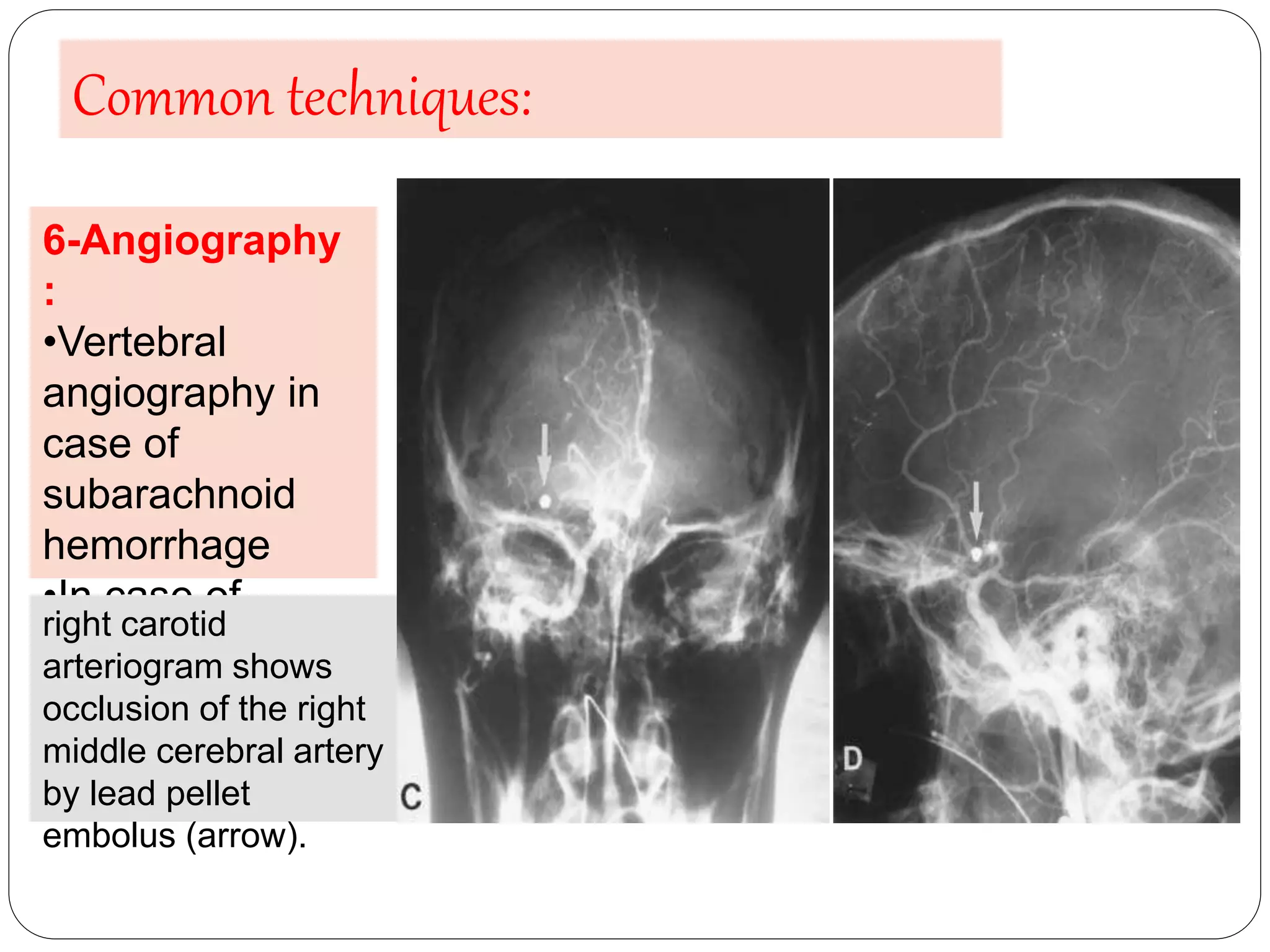 Presentation forensic radiology | PPTX
