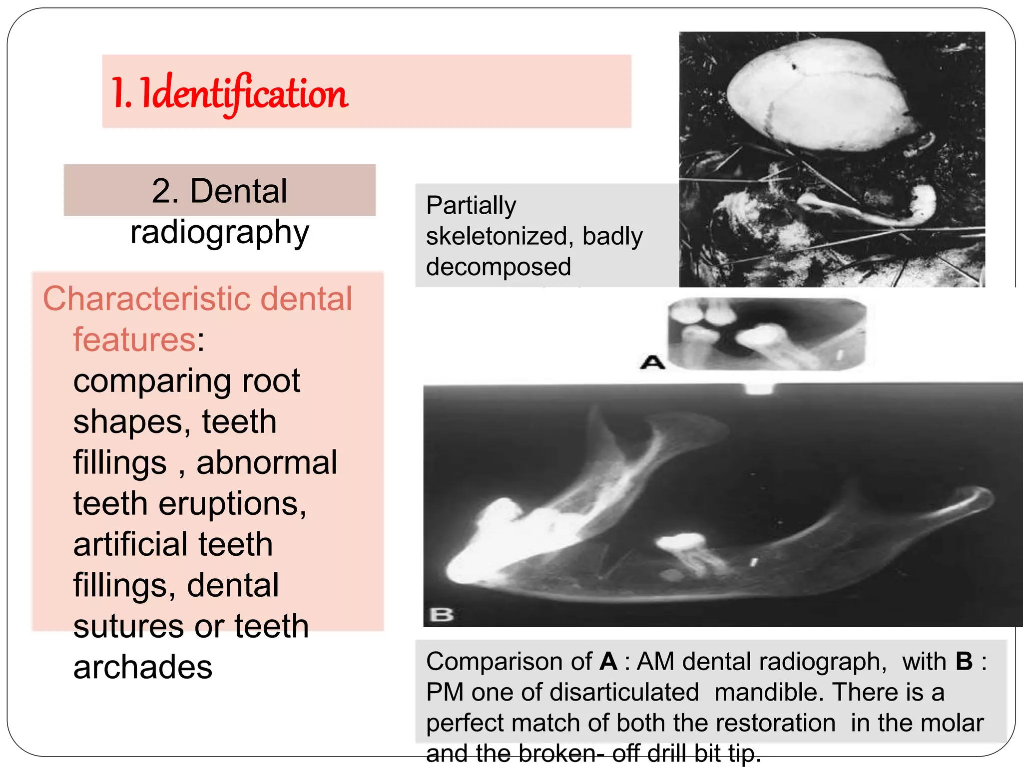 Presentation forensic radiology | PPTX
