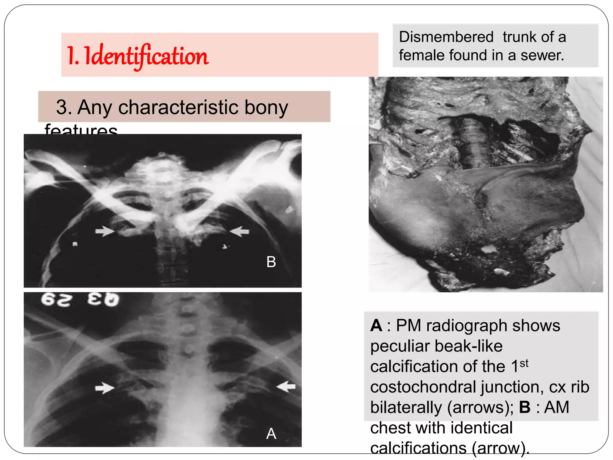 Presentation forensic radiology | PPTX