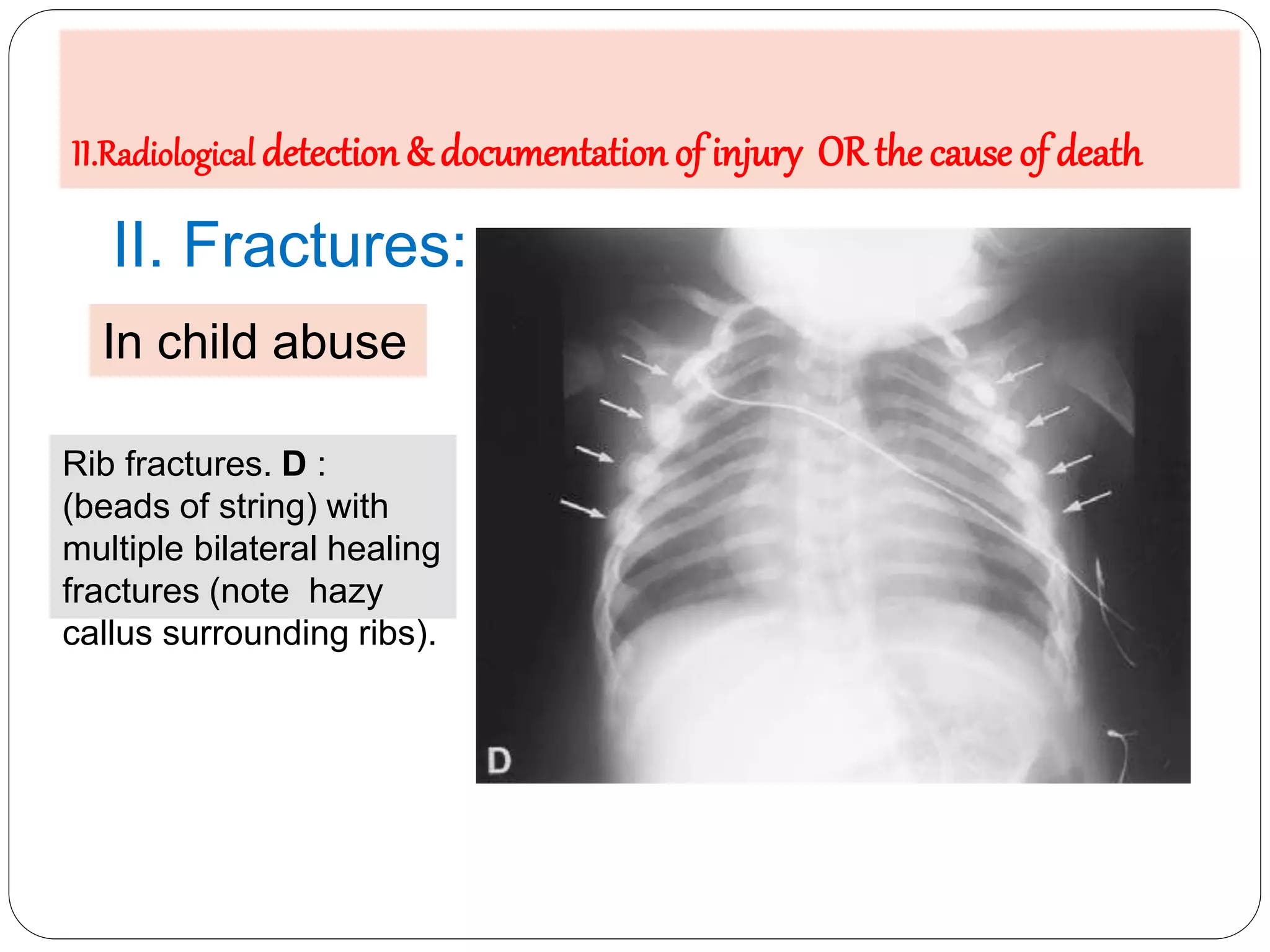 Presentation forensic radiology | PPTX