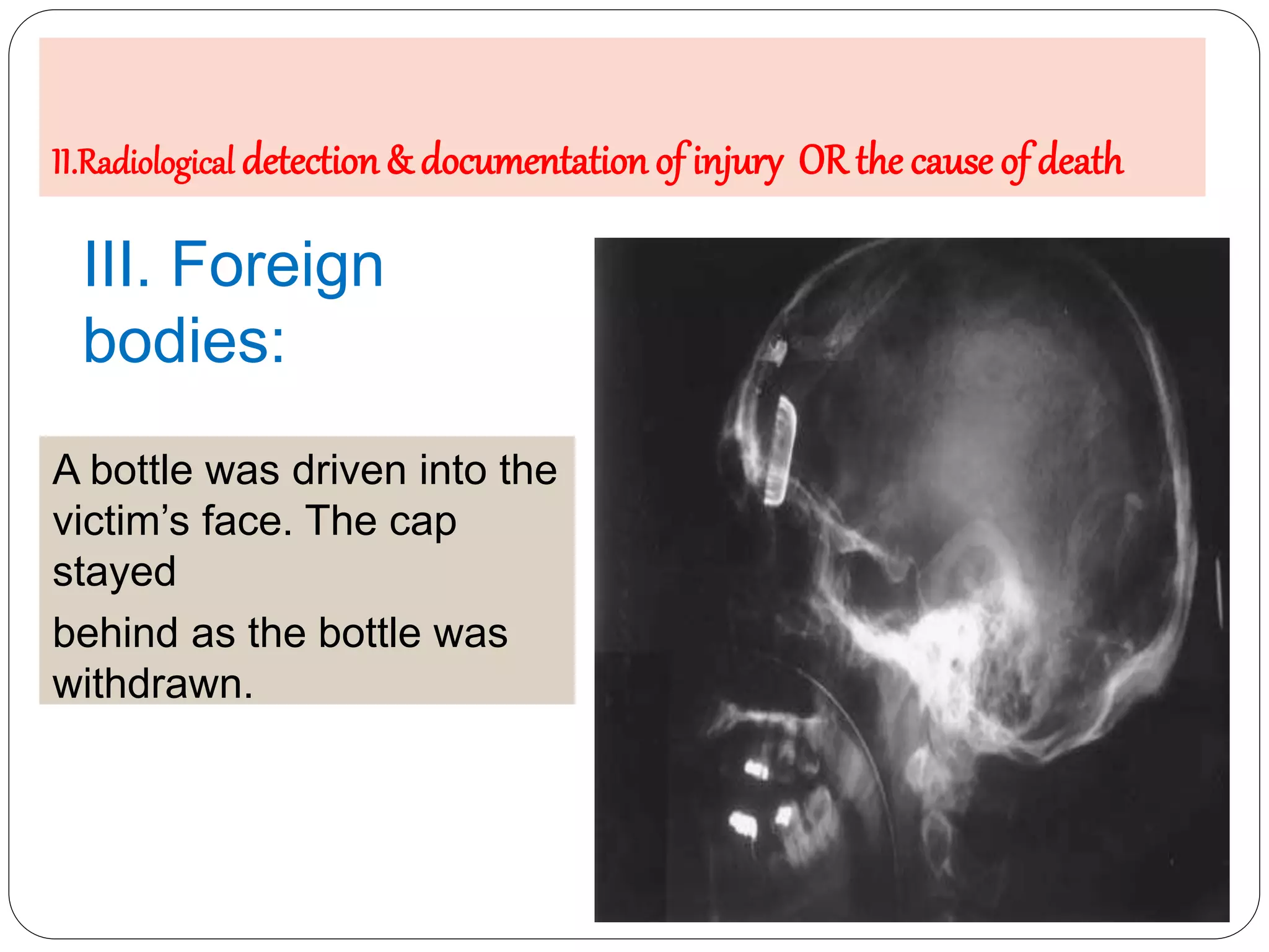 Presentation forensic radiology | PPTX