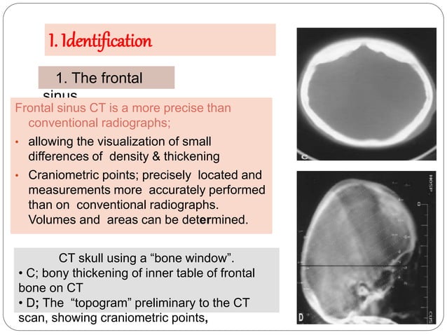 Presentation forensic radiology | PPTX