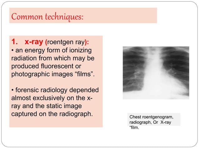 Presentation forensic radiology | PPTX