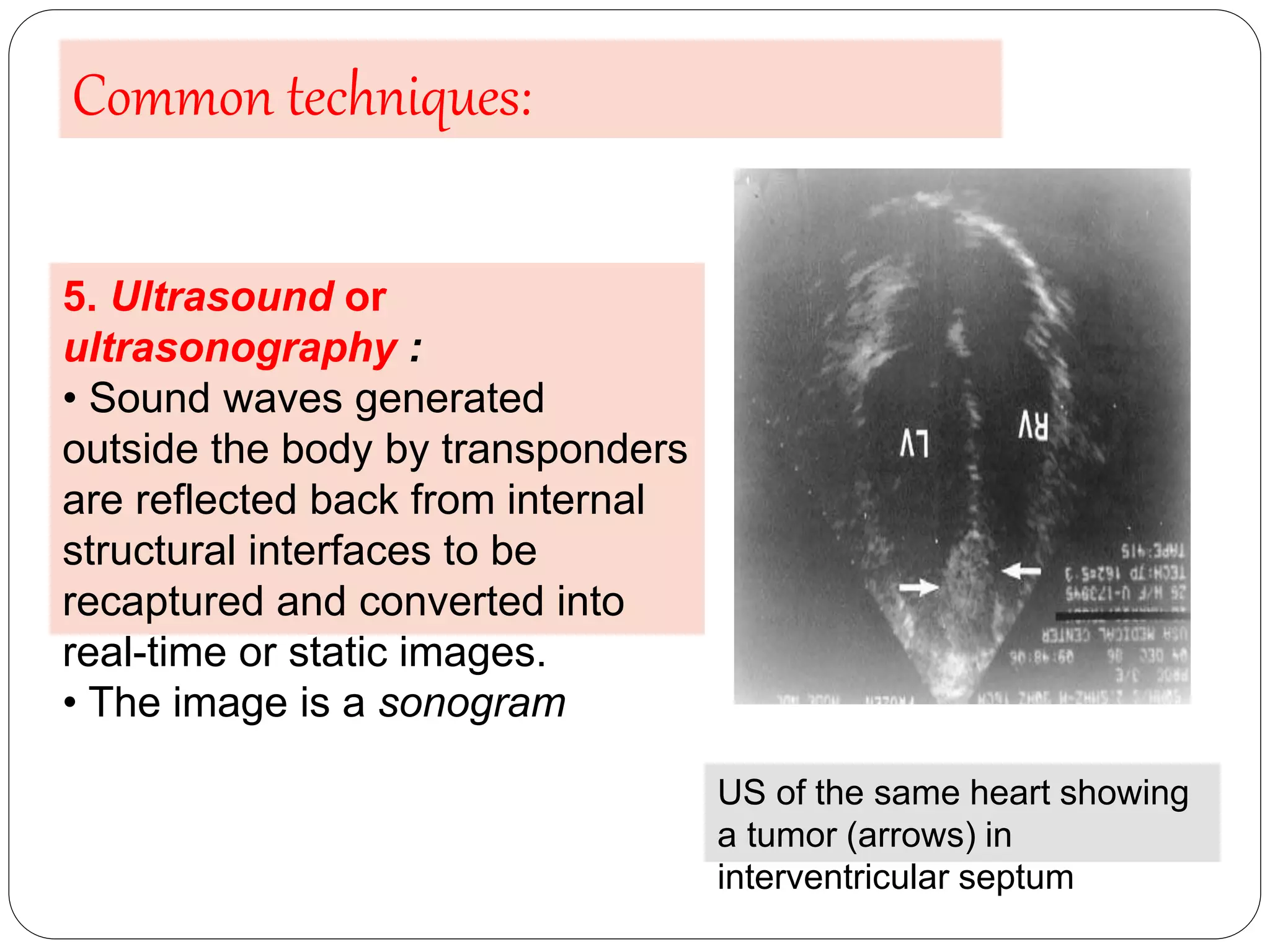 presentationforensicradiology_150419160811_conversion_gate02_2.pdf