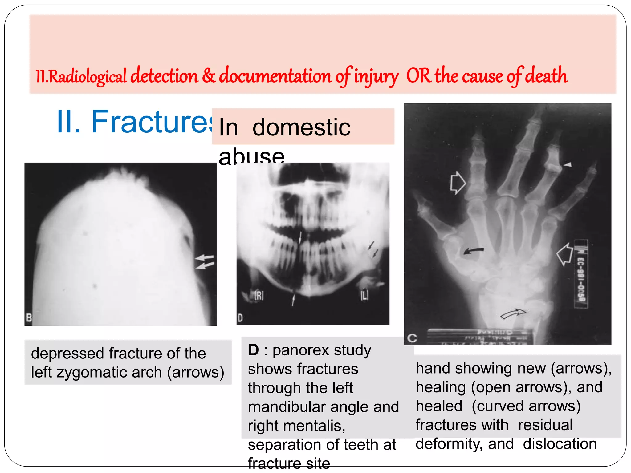 presentationforensicradiology_150419160811_conversion_gate02_2.pdf