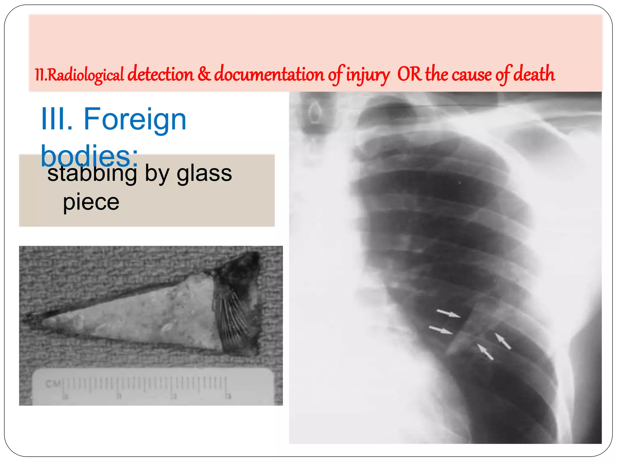 presentationforensicradiology_150419160811_conversion_gate02_2.pdf