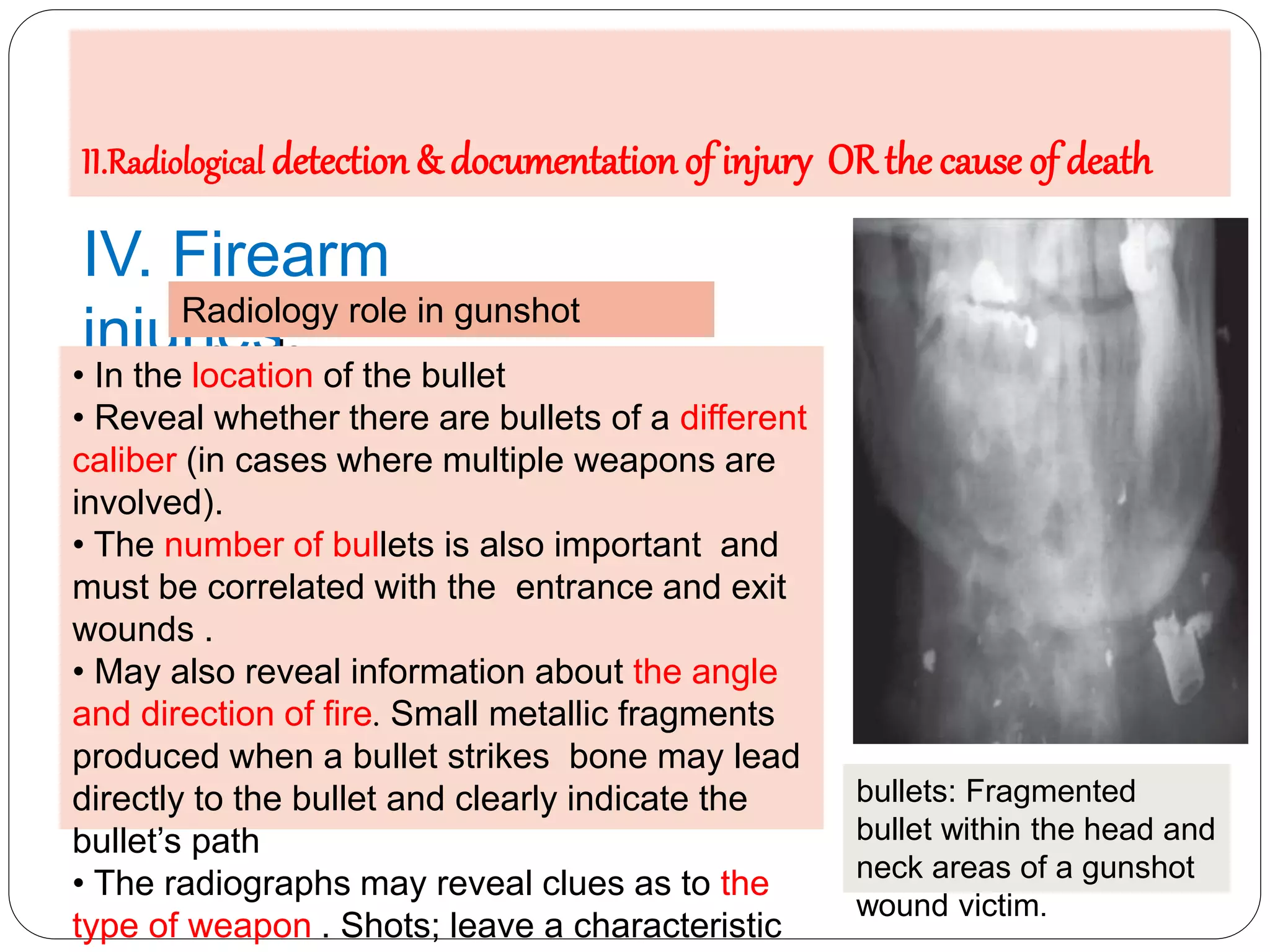 presentationforensicradiology_150419160811_conversion_gate02_2.pdf