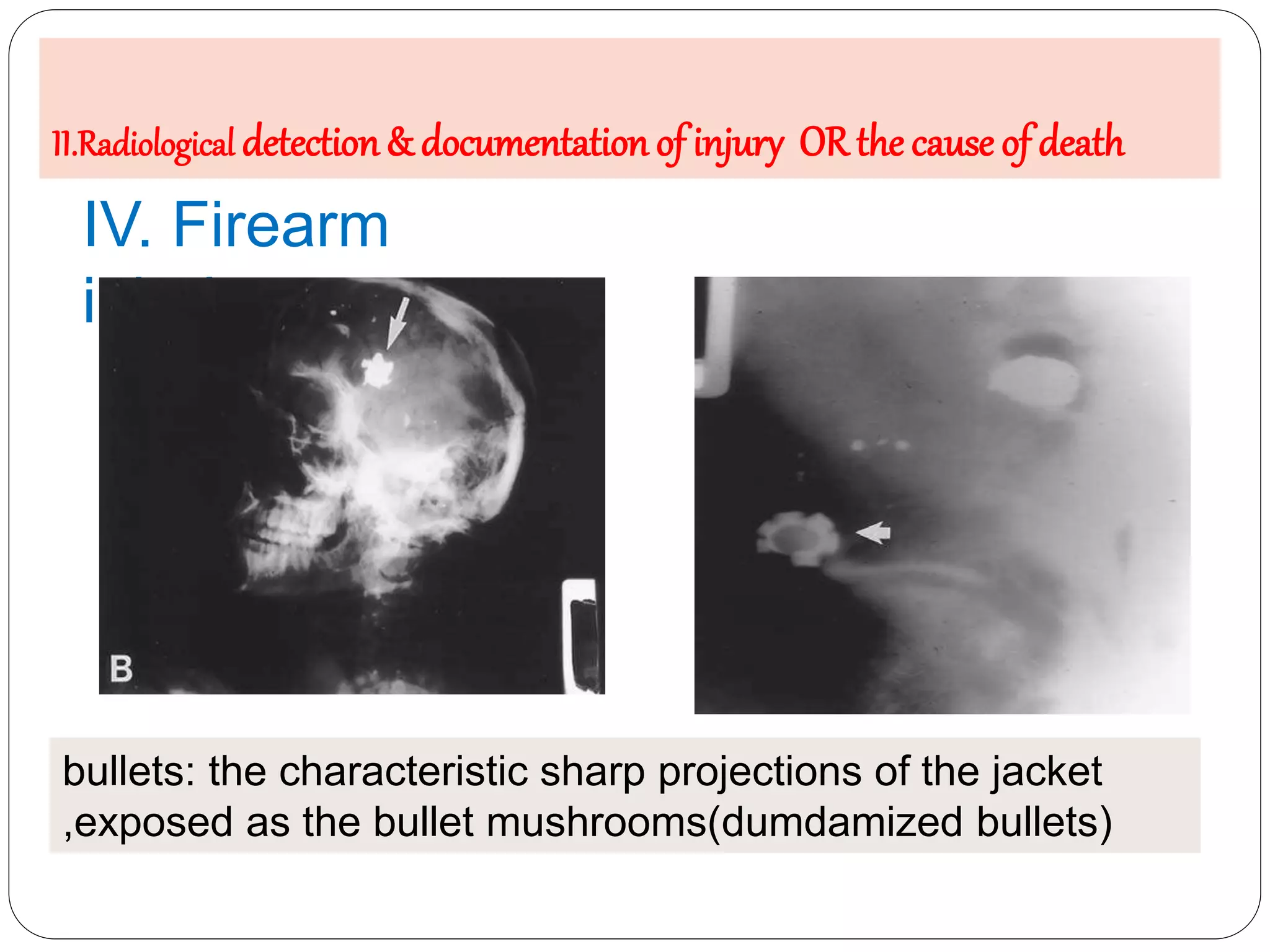 presentationforensicradiology_150419160811_conversion_gate02_2.pdf