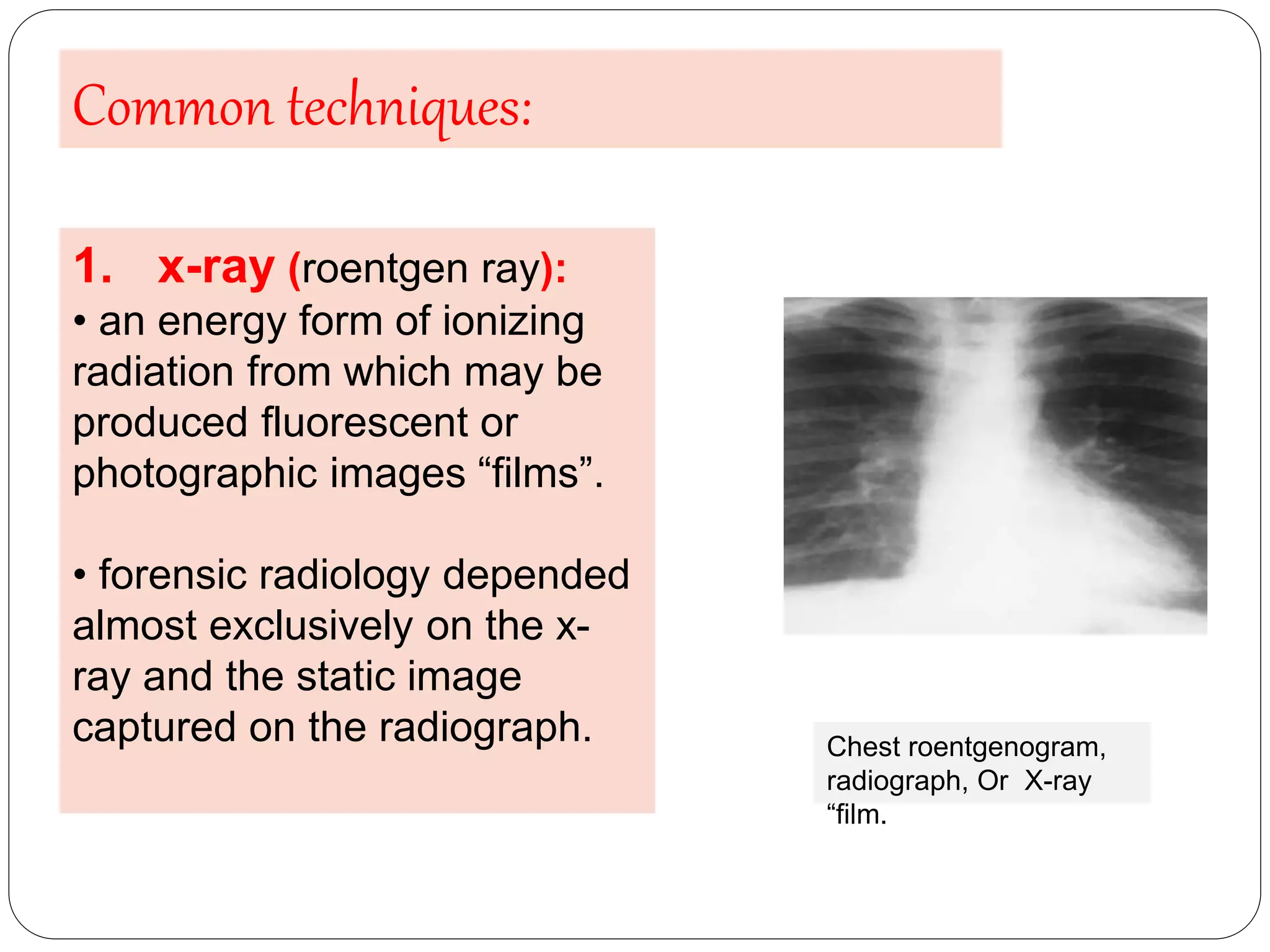 presentationforensicradiology_150419160811_conversion_gate02_2.pdf