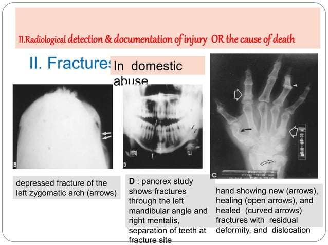 presentationforensicradiology_150419160811_conversion_gate02_2.pdf