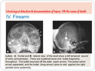 presentationforensicradiology_150419160811_conversion_gate02_2.pdf