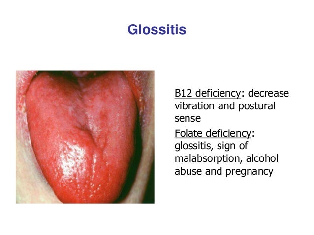 Approach To A Patient With Anemia