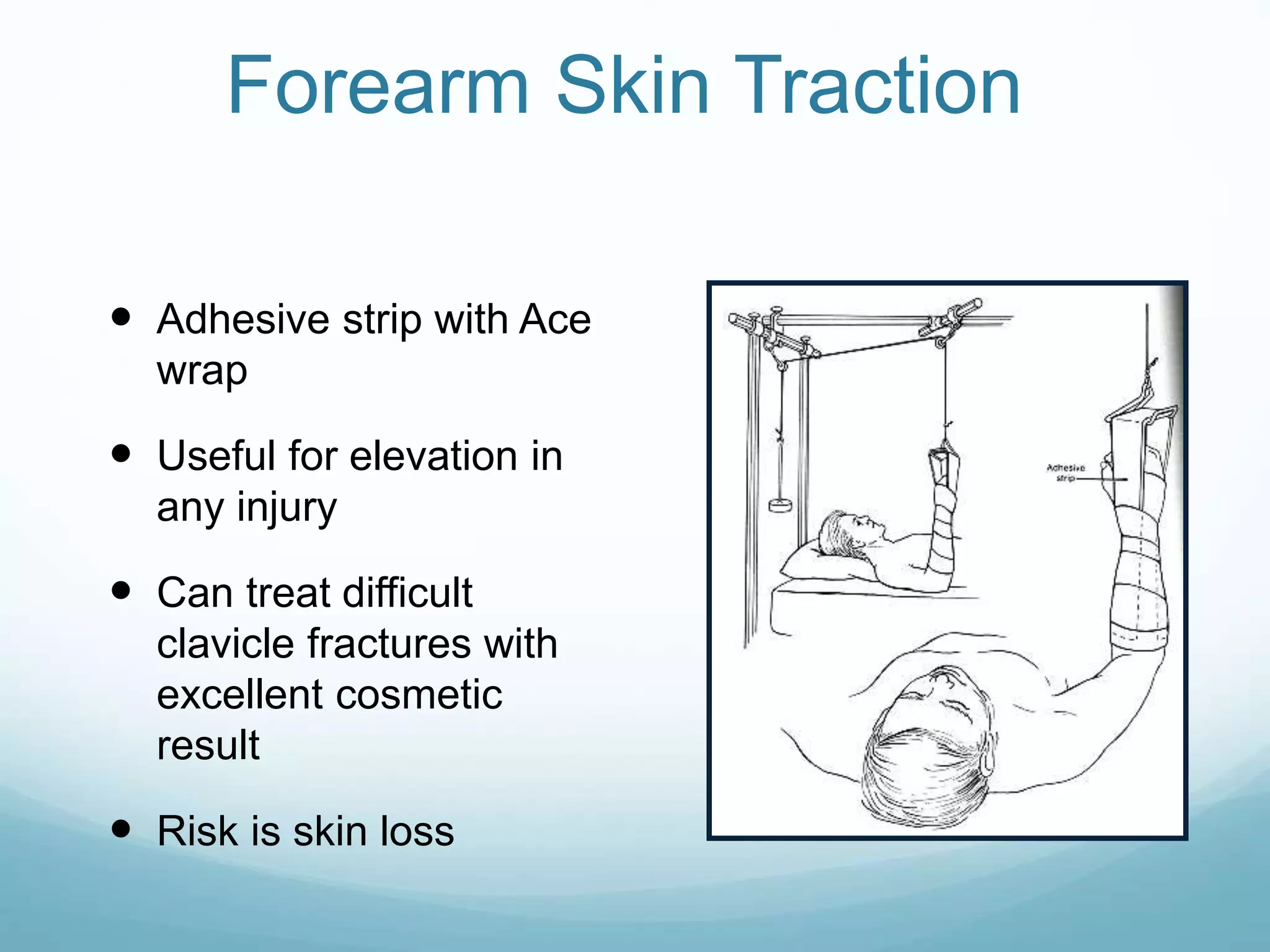 Presentation for skin traction | PPTX