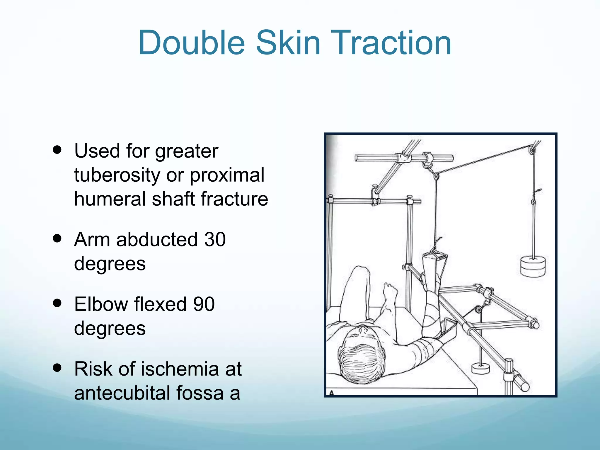 Presentation for skin traction | PPTX