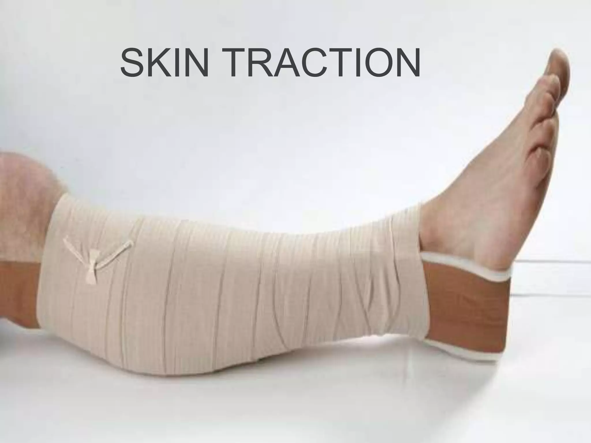Presentation for skin traction | PPTX