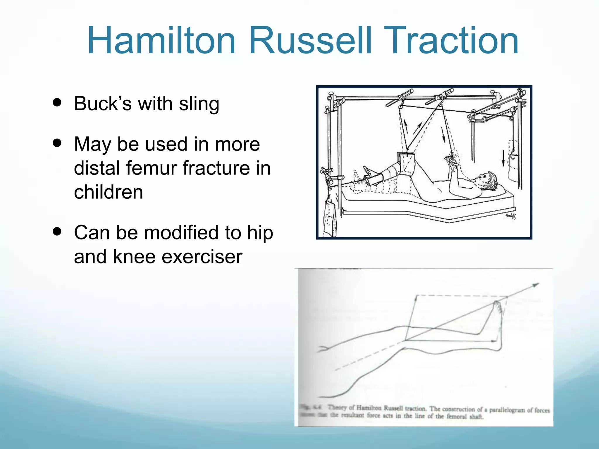 Presentation for skin traction | PPTX