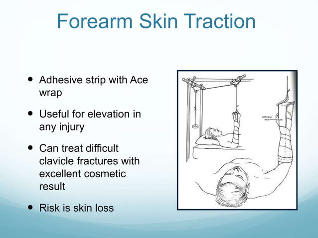 Presentation for skin traction | PPTX | Death, Injury, or Military ...