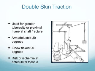 Presentation for skin traction | PPTX