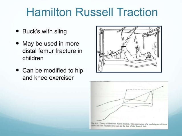 Presentation for skin traction | PPTX | Death, Injury, or Military ...