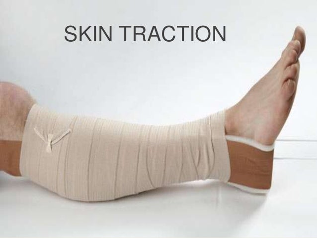 Presentation for skin traction