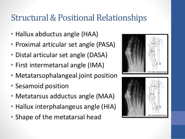 Presentation frontal plane correction in hav surgery