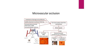 Fundoscopy, DM-retinopathy and HTN- retinopathy ppt | PPTX