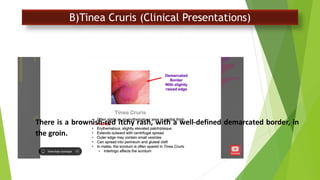 Presentation on Fungal Infections in human | PPT