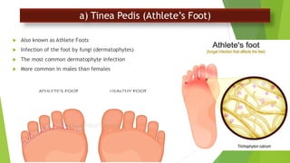 Presentation on Fungal Infections in human | PDF