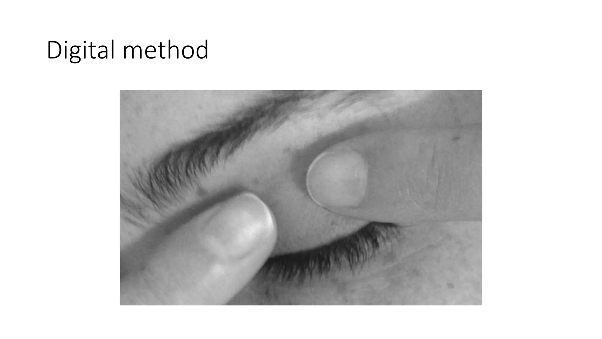 Gradual Visual loss.pptx