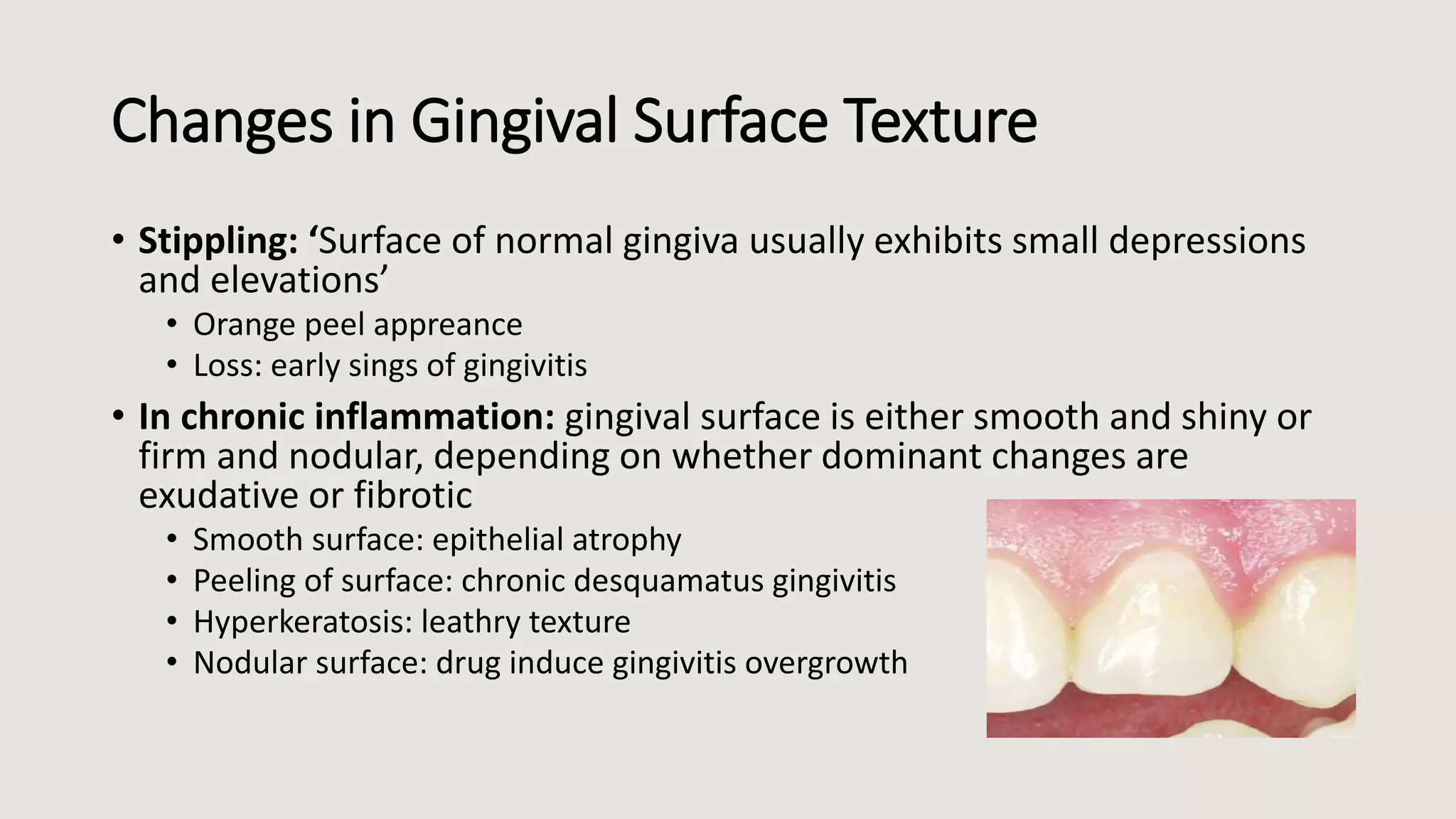 Gingival changes | PPT