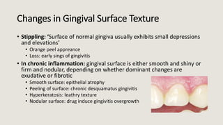 Gingival changes | PPT