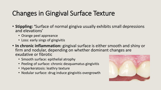 Gingival changes | PPT