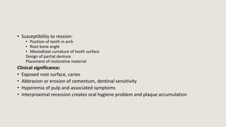 Gingival changes | PPT