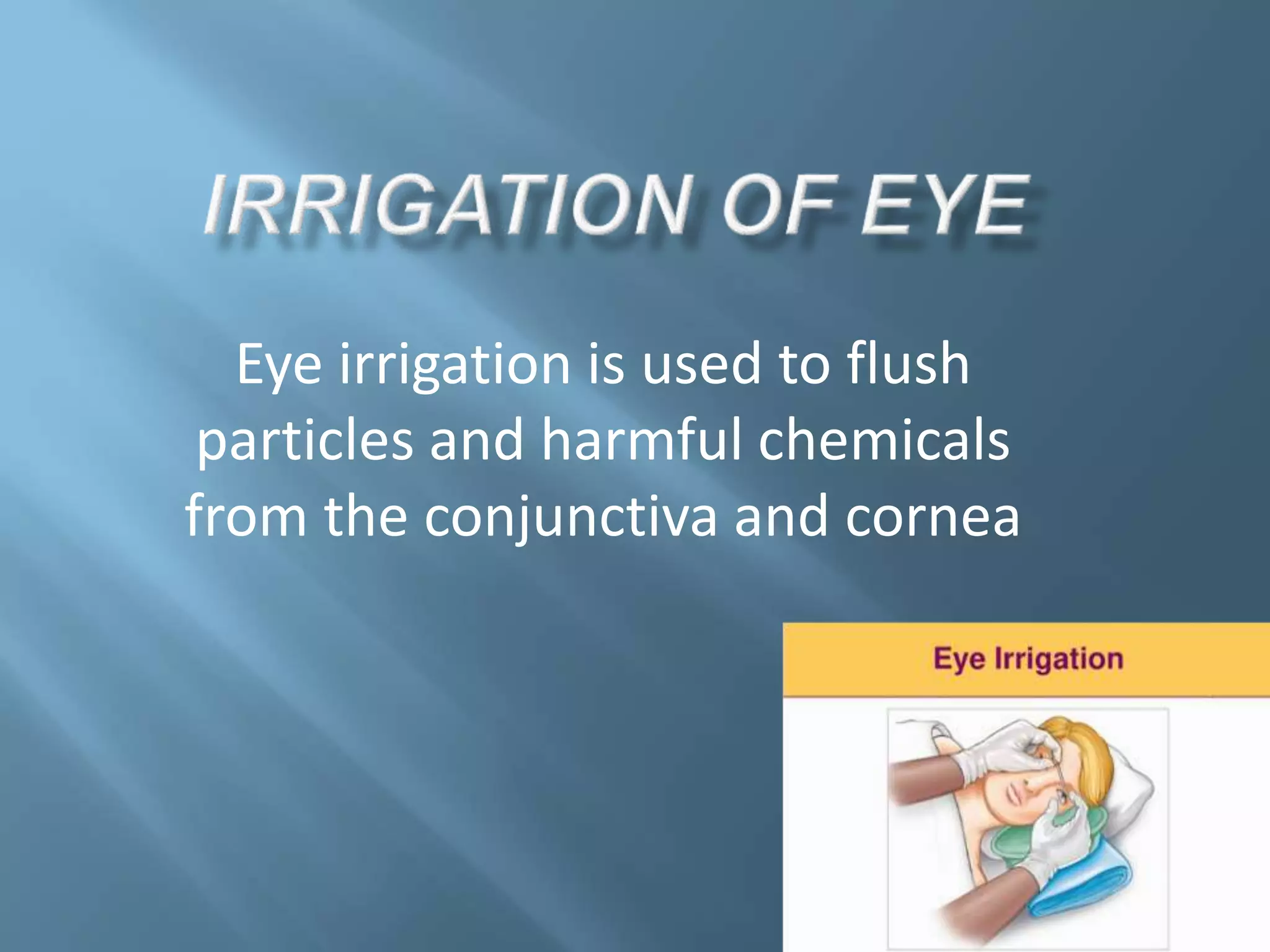 eye irrigation.pptx