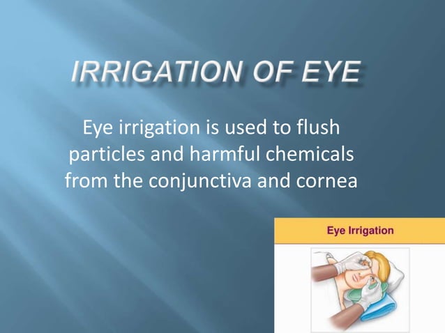 eye irrigation.pptx