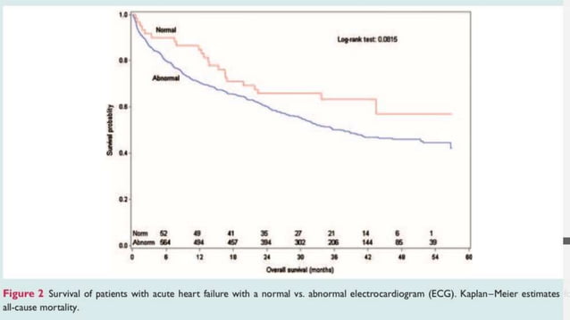 ECG and Acute Heart Failure, ECG,HF. | PPTX | Heart and Cardiovascular ...