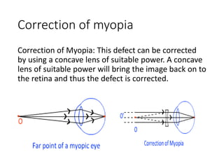 presentation_human_eye_.pptx