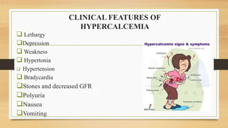 Presentation HYPERCALCEMIA.pptx