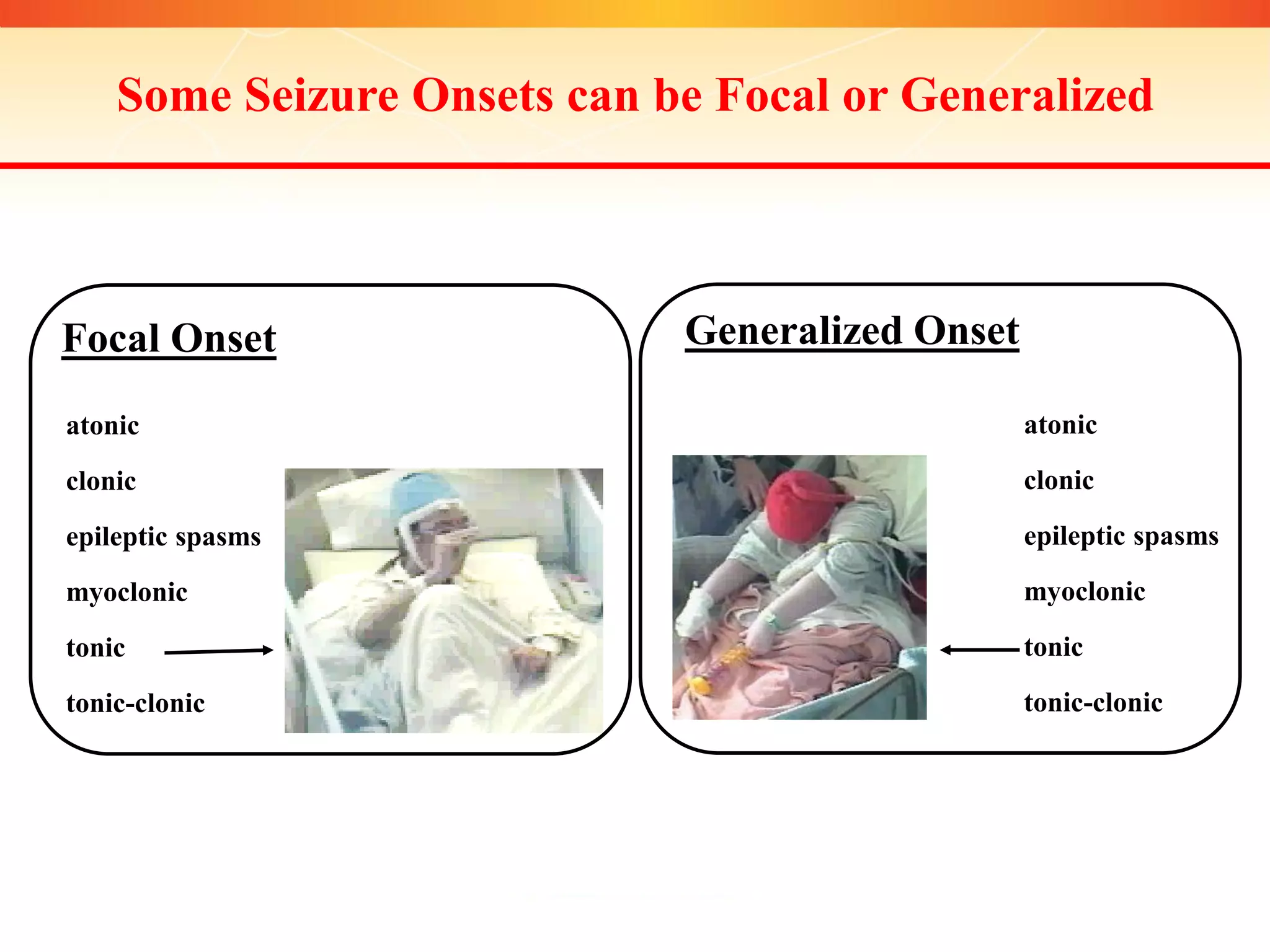 Presentation illustrating the 2017 classification of seizure types(1 ...