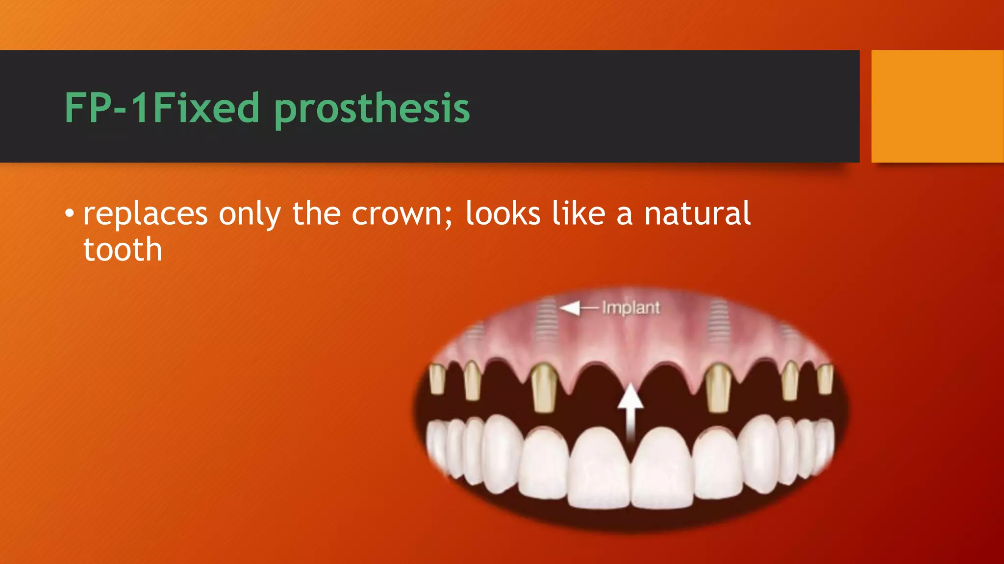Dental implant prosthesis | PPTX