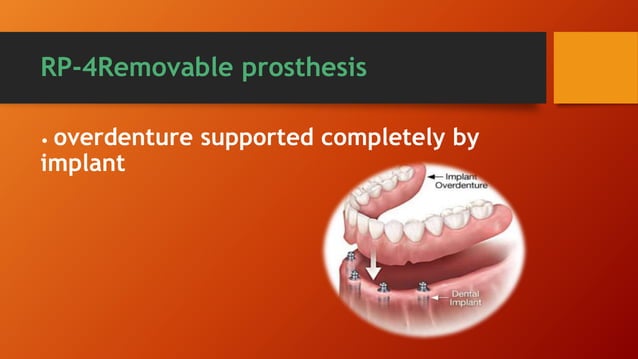 Dental implant prosthesis | PPTX