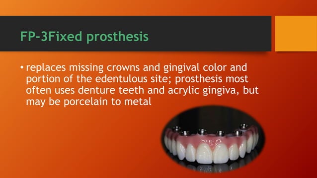 Dental implant prosthesis | PPTX