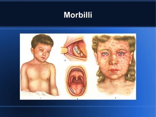 Rash differential Diagnosis of Infectious diseases | PPT
